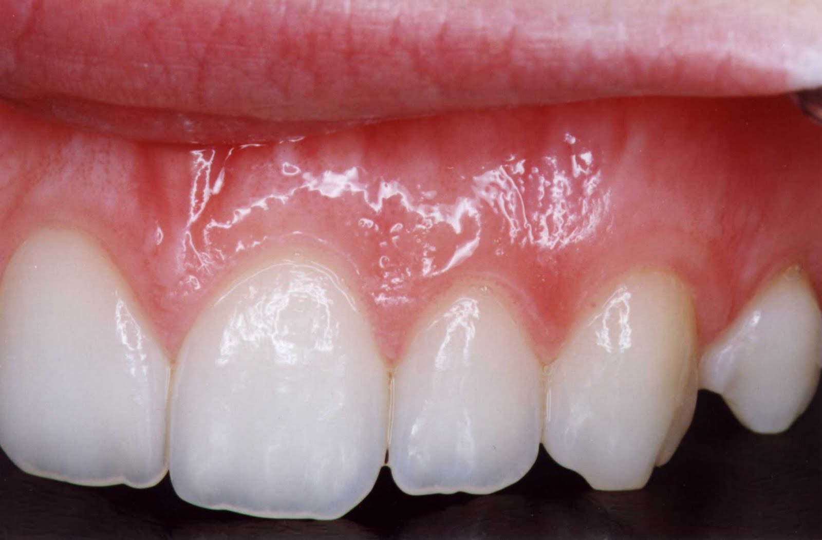 PERIODONTIA - NOF Clínica Odontológica